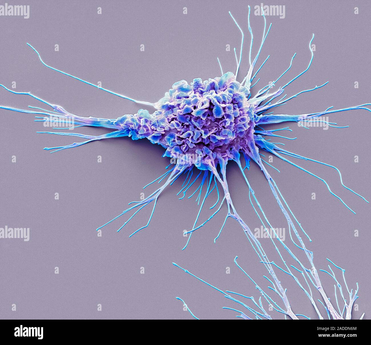 Dendritic cell. Coloured scanning electron micrograph (SEM) of a ...