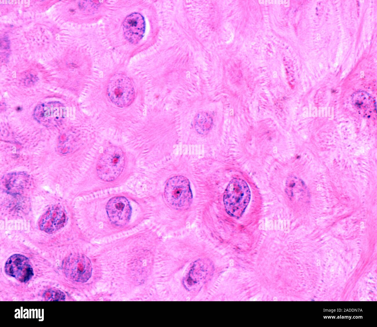 Light micrograph of epidermis showing the keratinocytes of spinous ...