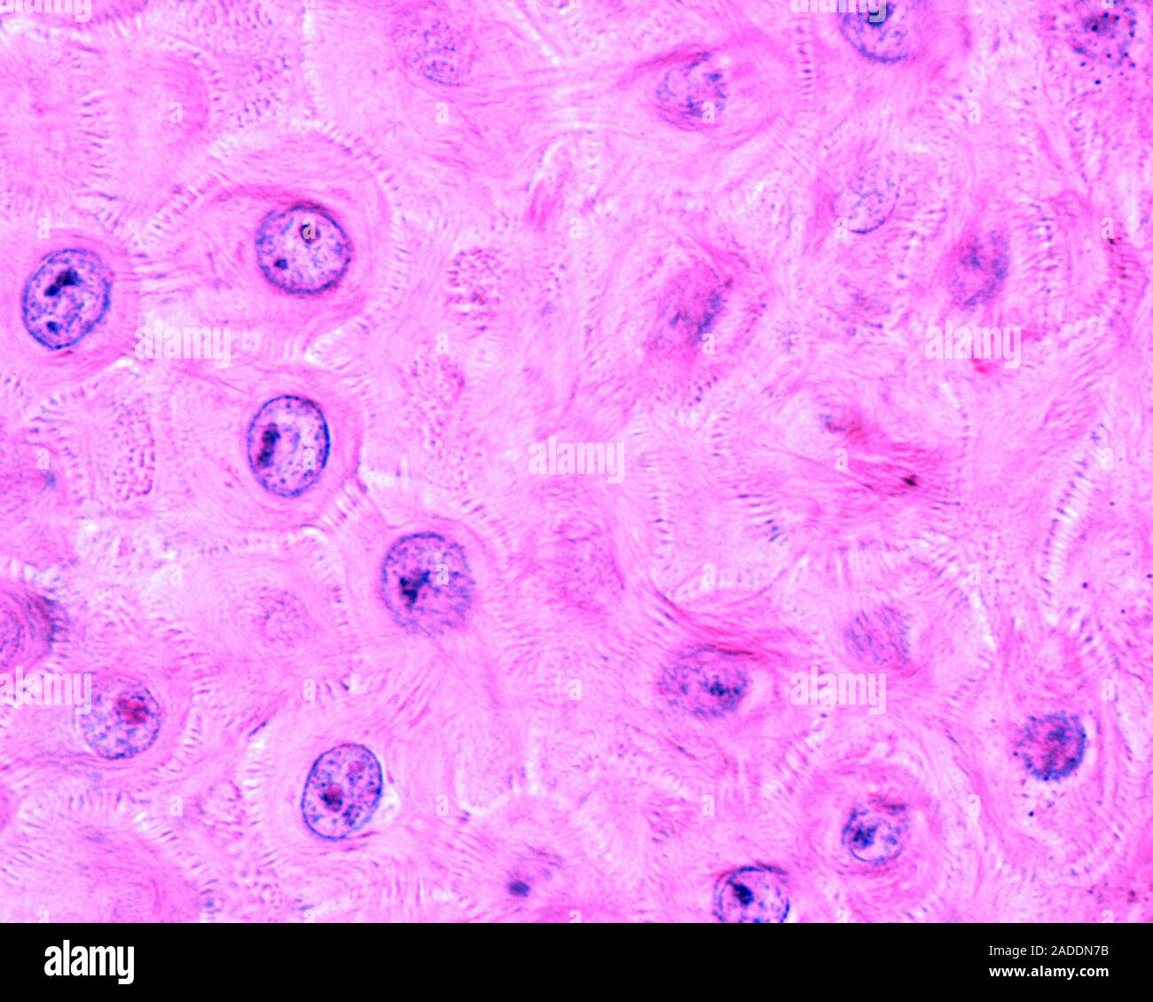 Light micrograph of epidermis showing the keratinocytes of spinous ...