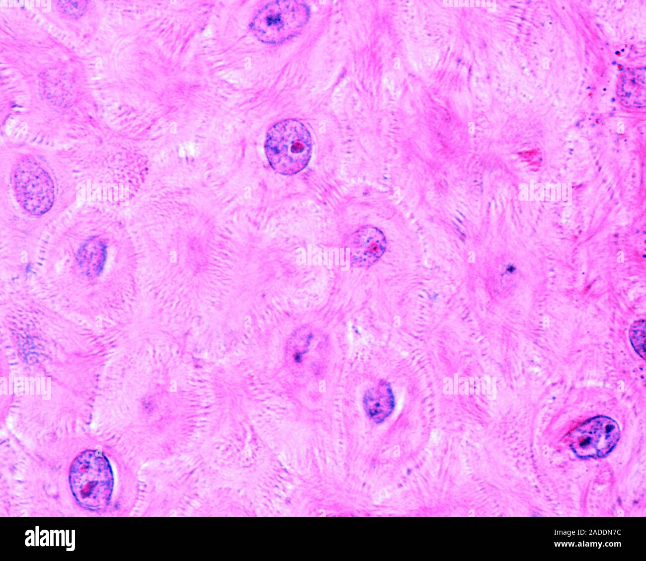 Light micrograph of epidermis showing the keratinocytes of spinous ...