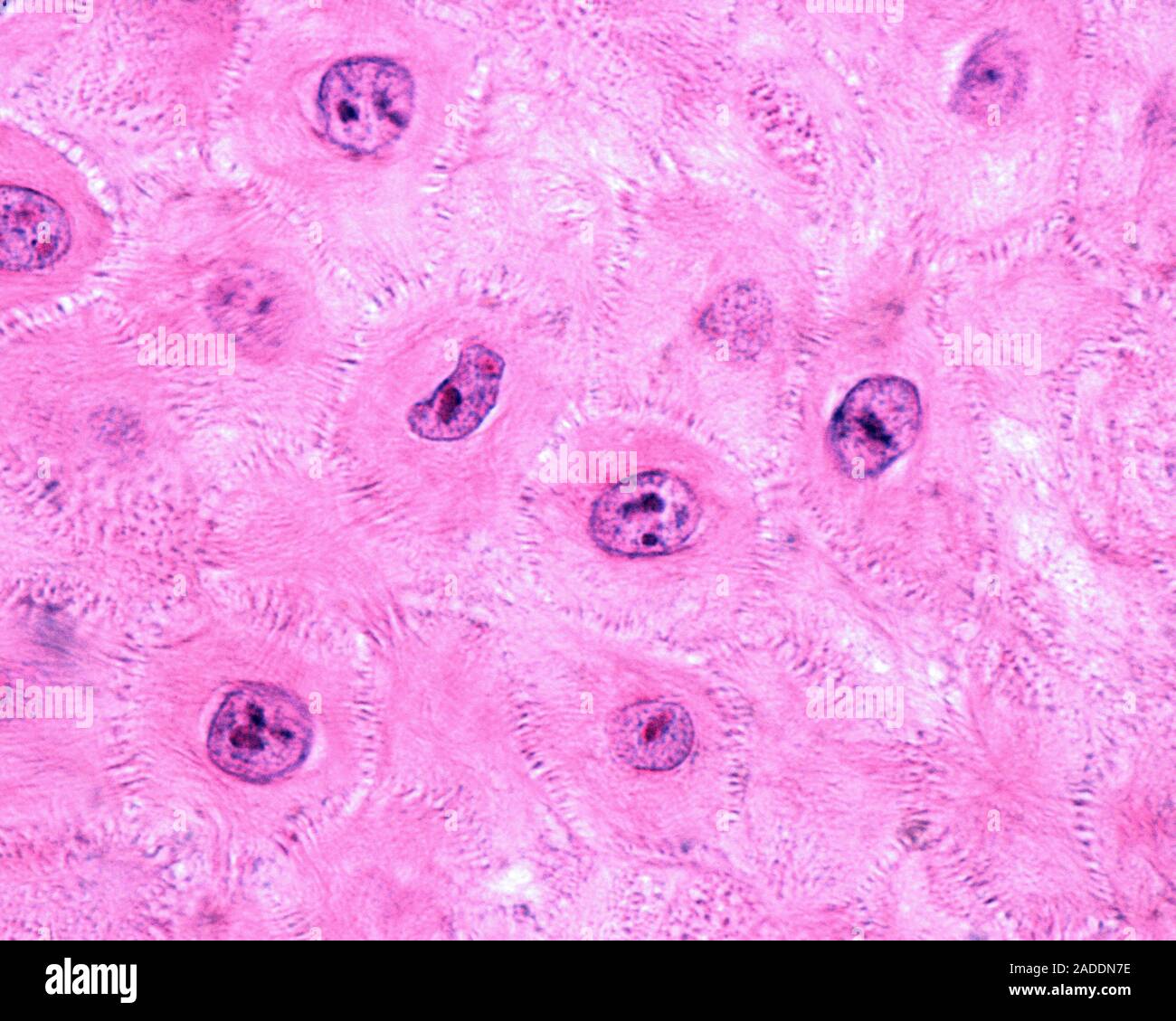 Light micrograph of epidermis showing the keratinocytes of spinous ...