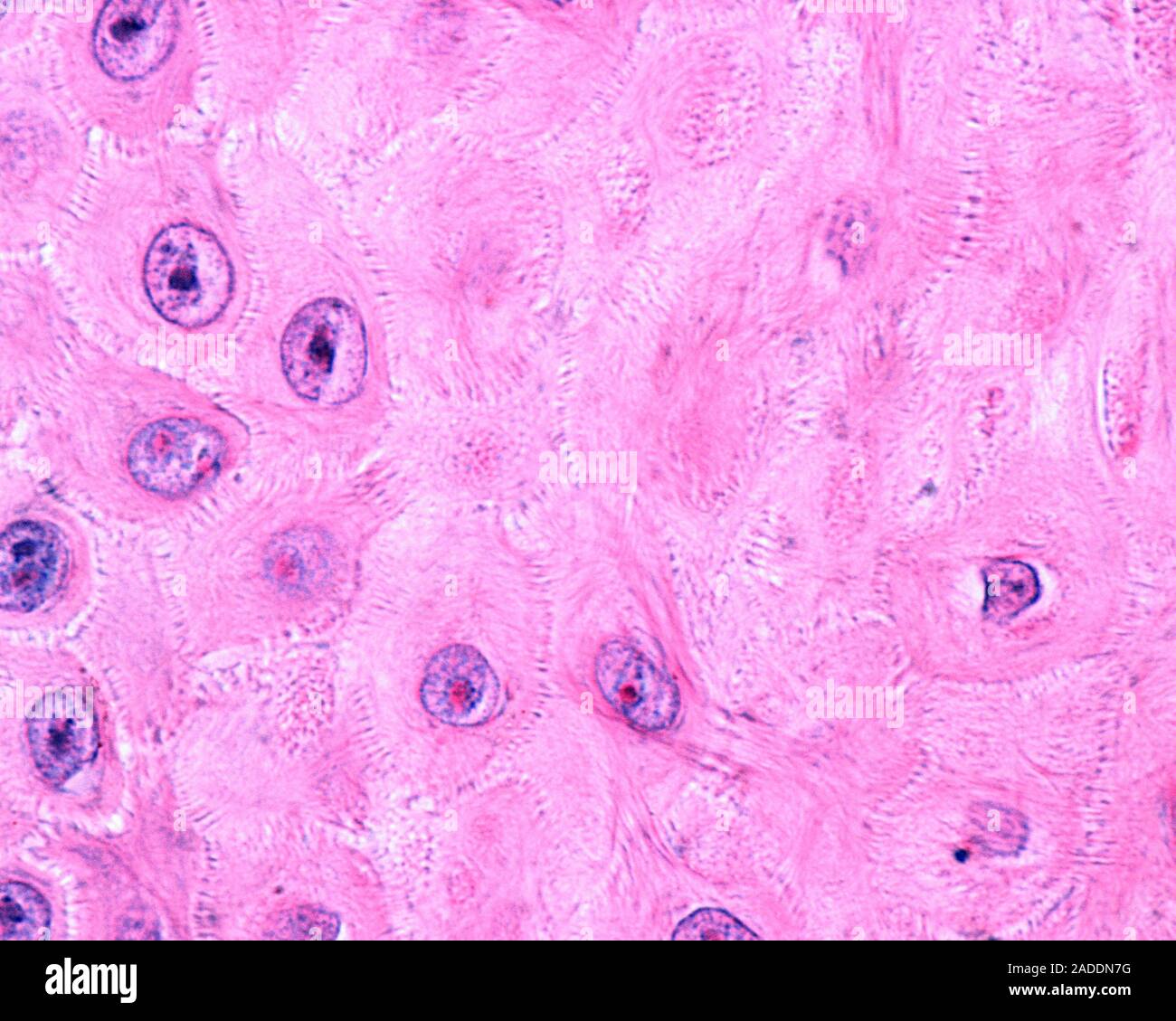 Light micrograph of epidermis showing the keratinocytes of spinous ...