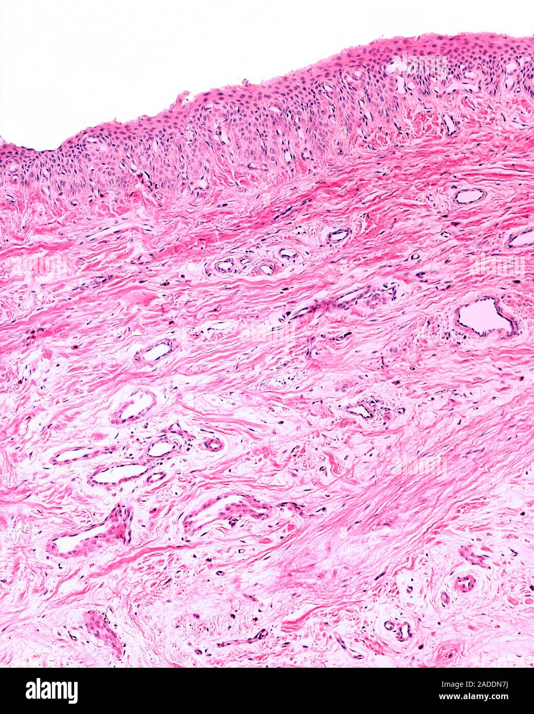 Nail bed, light micrograph. In this region the epithelium (top ...