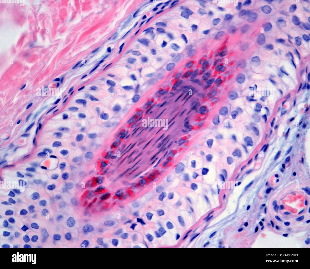 Light micrograph of an oblique section of a human hair follicle. From ...
