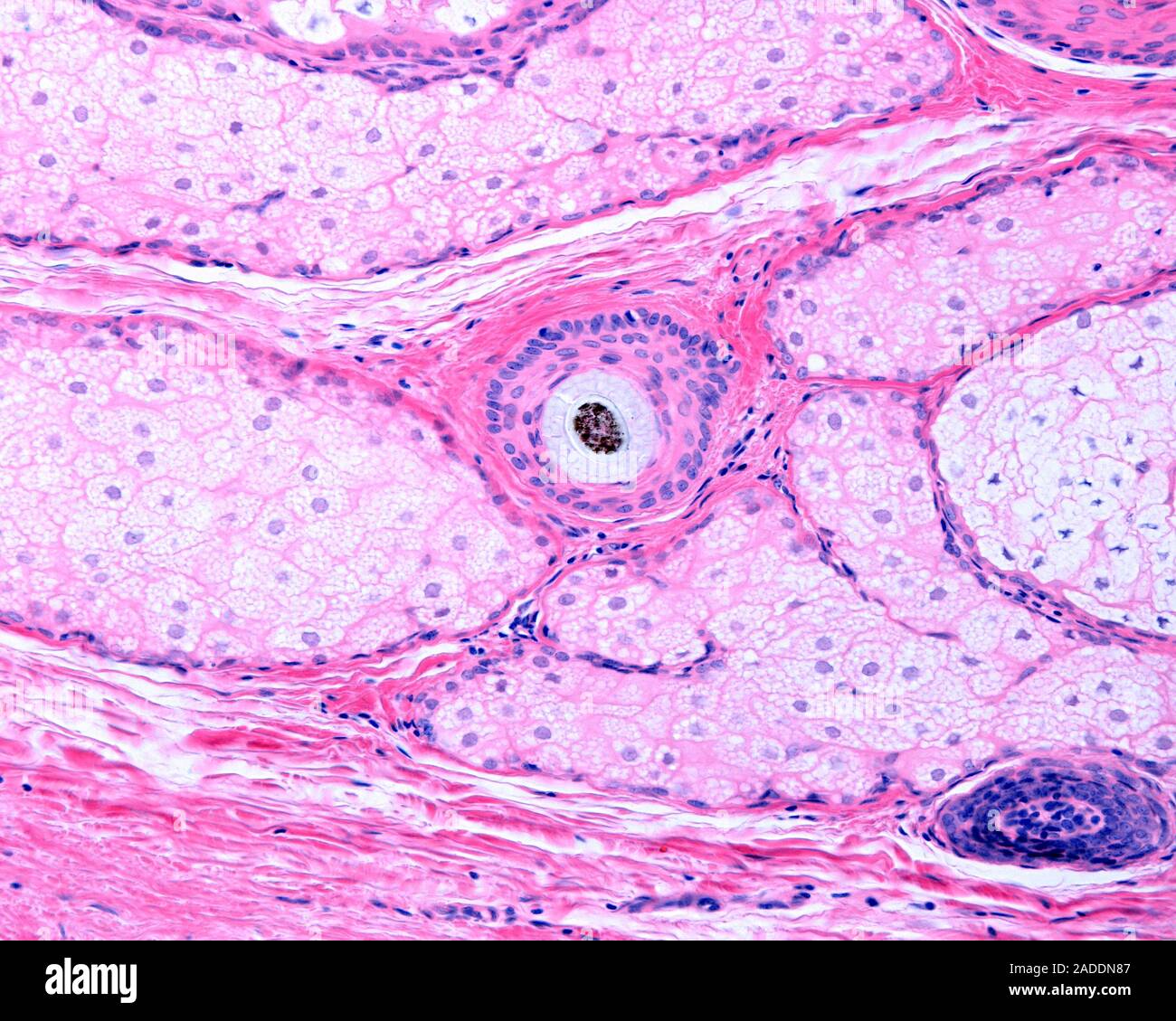 Sebaceous Glands Under Microscope