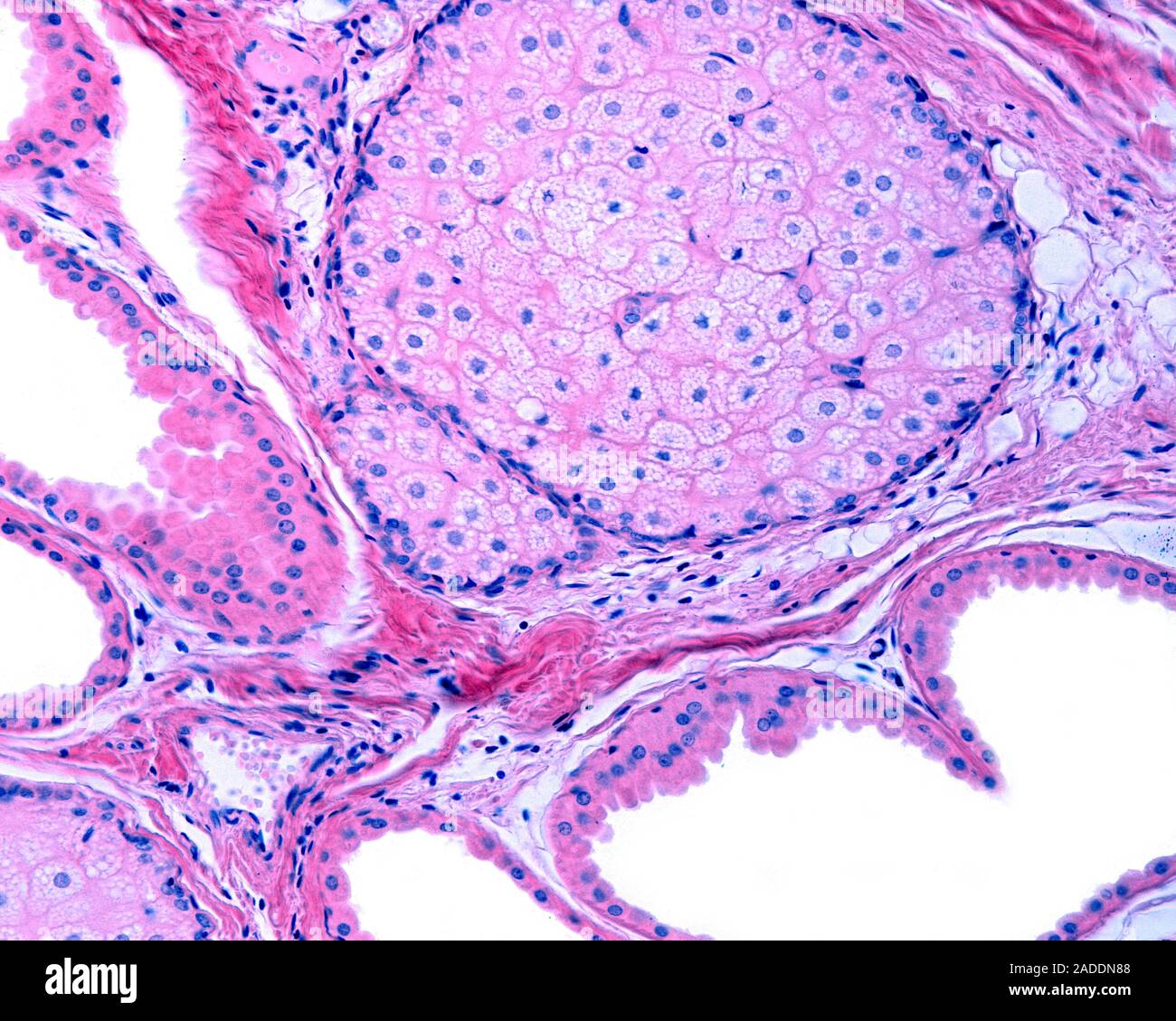 Light micrograph of secretory units of sebaceous (top centre) and ...
