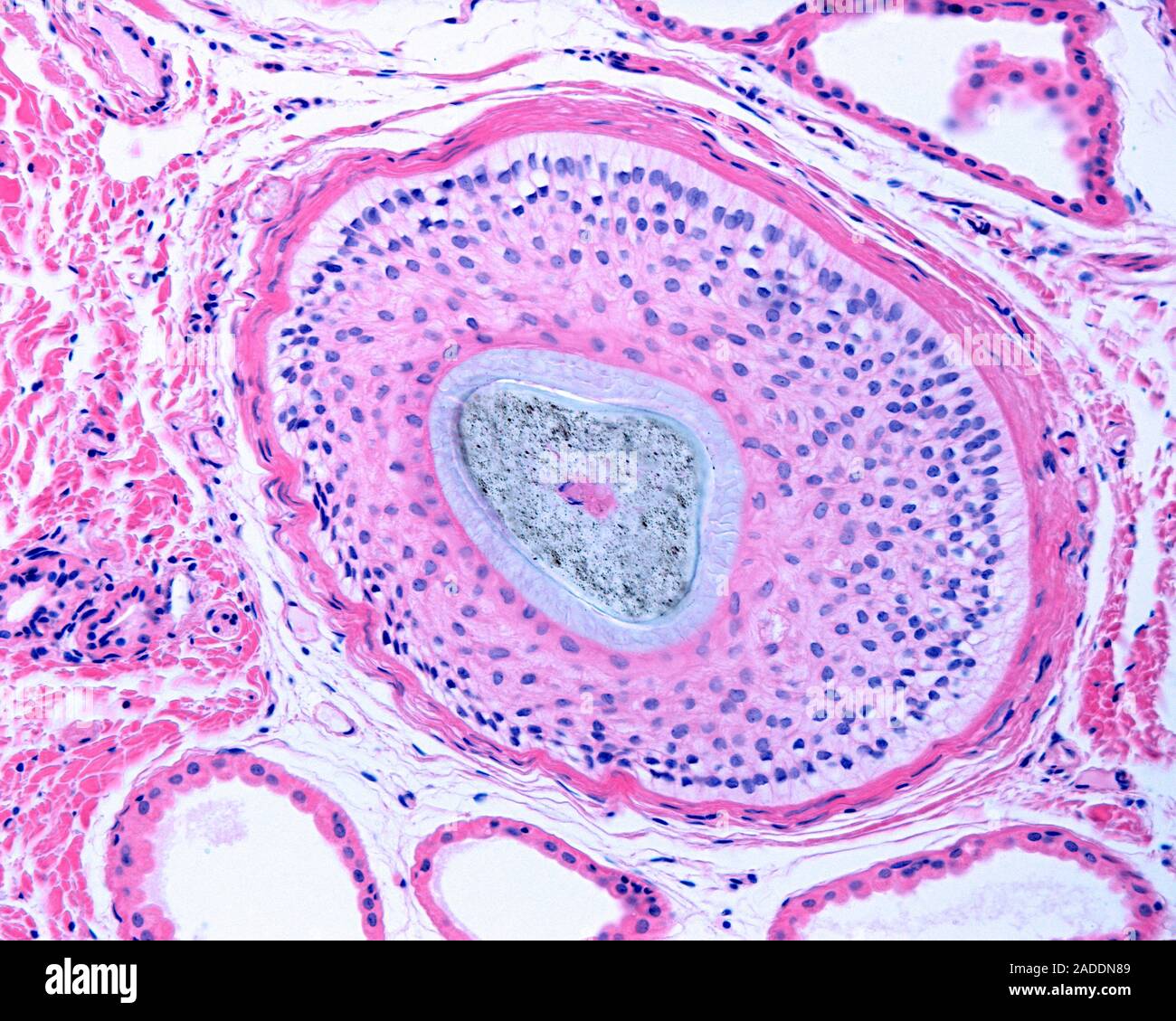 Light micrograph of a cross section of a hair follicle. From the inside ...