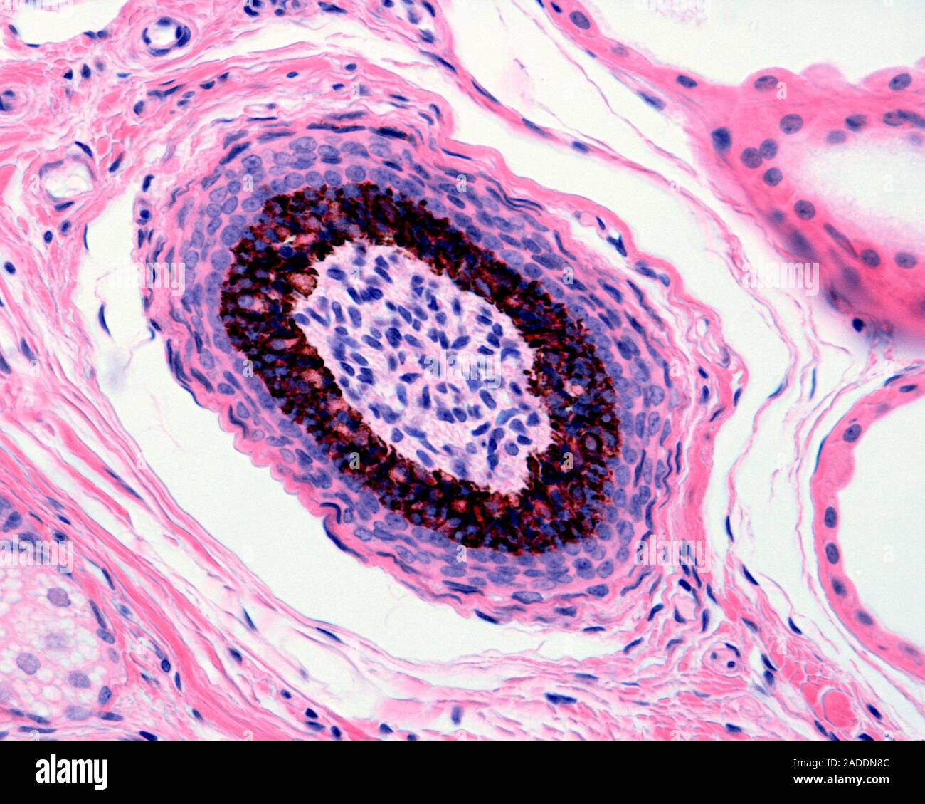 Light micrograph of a cross section of a hair follicle at the level of ...