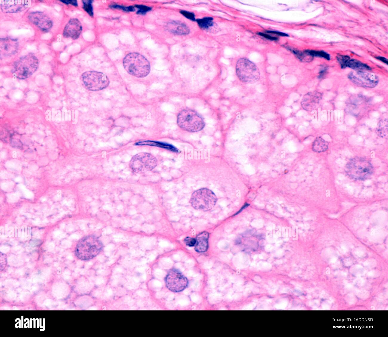 Sebaceous gland, light micrograph. The sebaceous gland is a holocrine ...