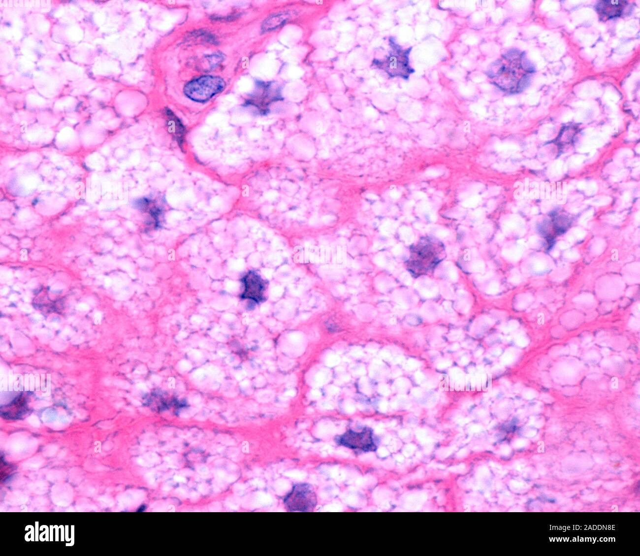 Sebaceous gland, light micrograph. The sebaceous gland is a holocrine ...