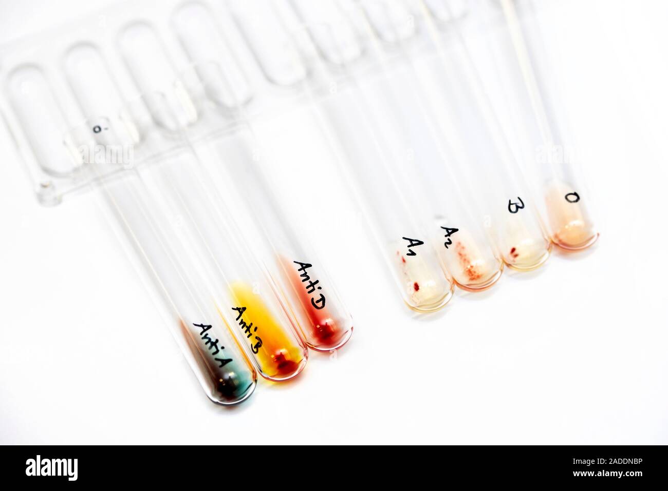 Blood group test. Test tubes with antibody testing showing the result ...