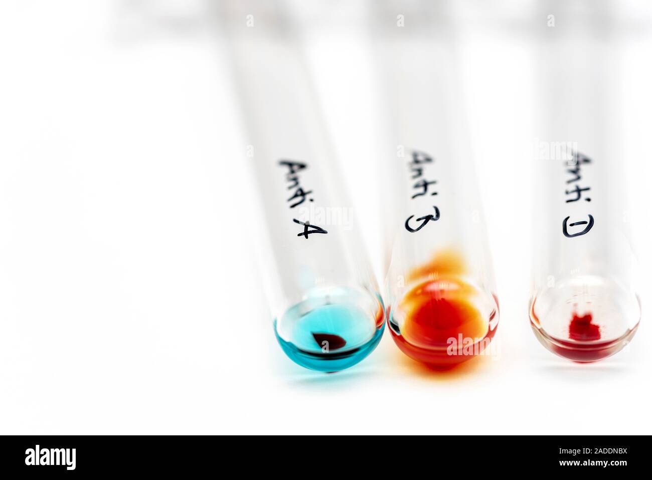Blood group test. Test tubes with antibody testing showing the result ...