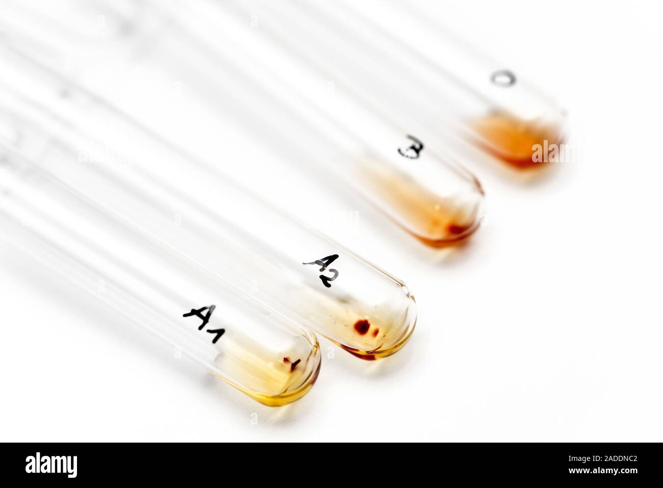 Blood group test. Test tubes with reverse typing showing the result for ...