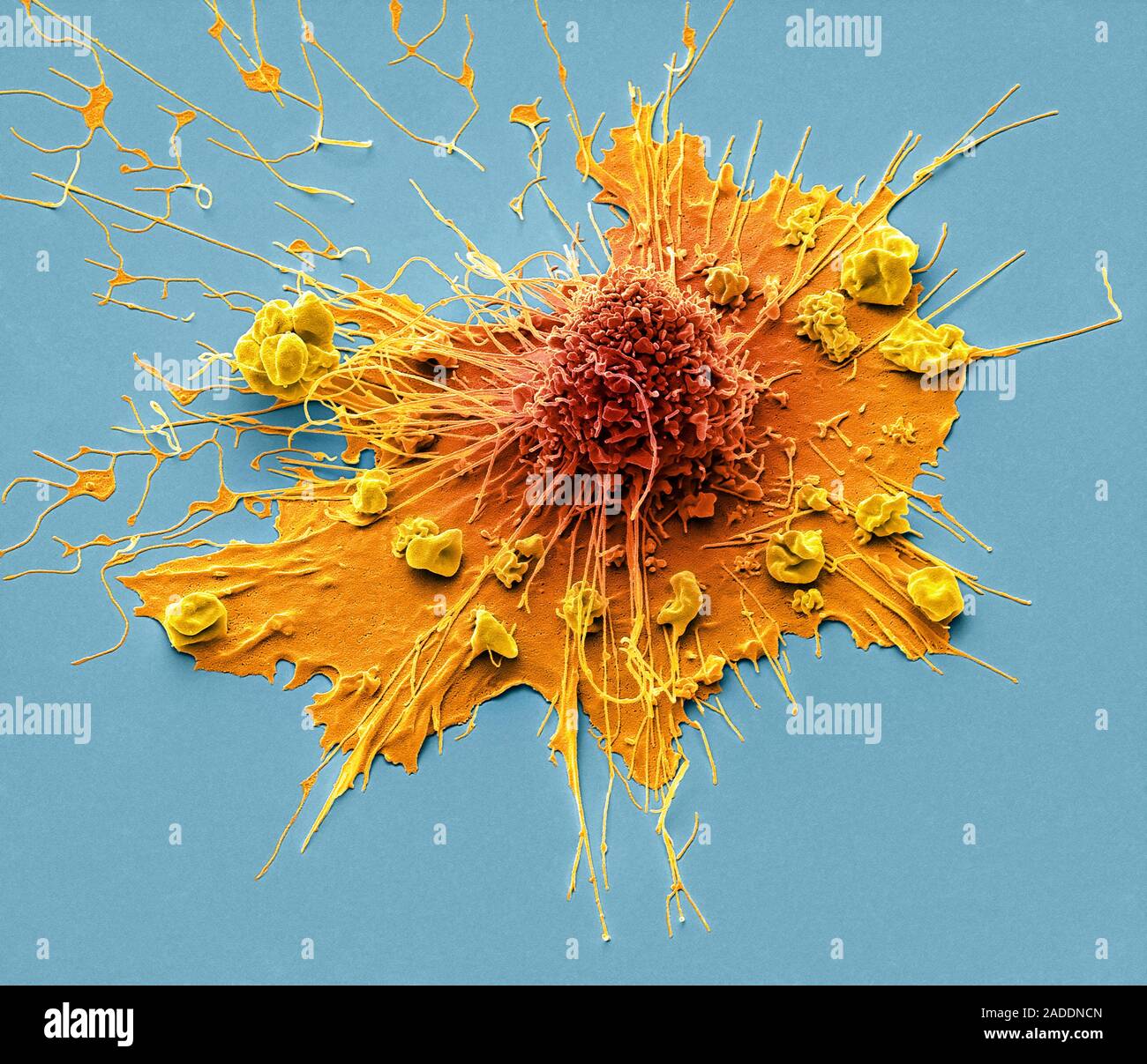 Fibroblast cell. Coloured scanning electron micrograph of a mammalian ...