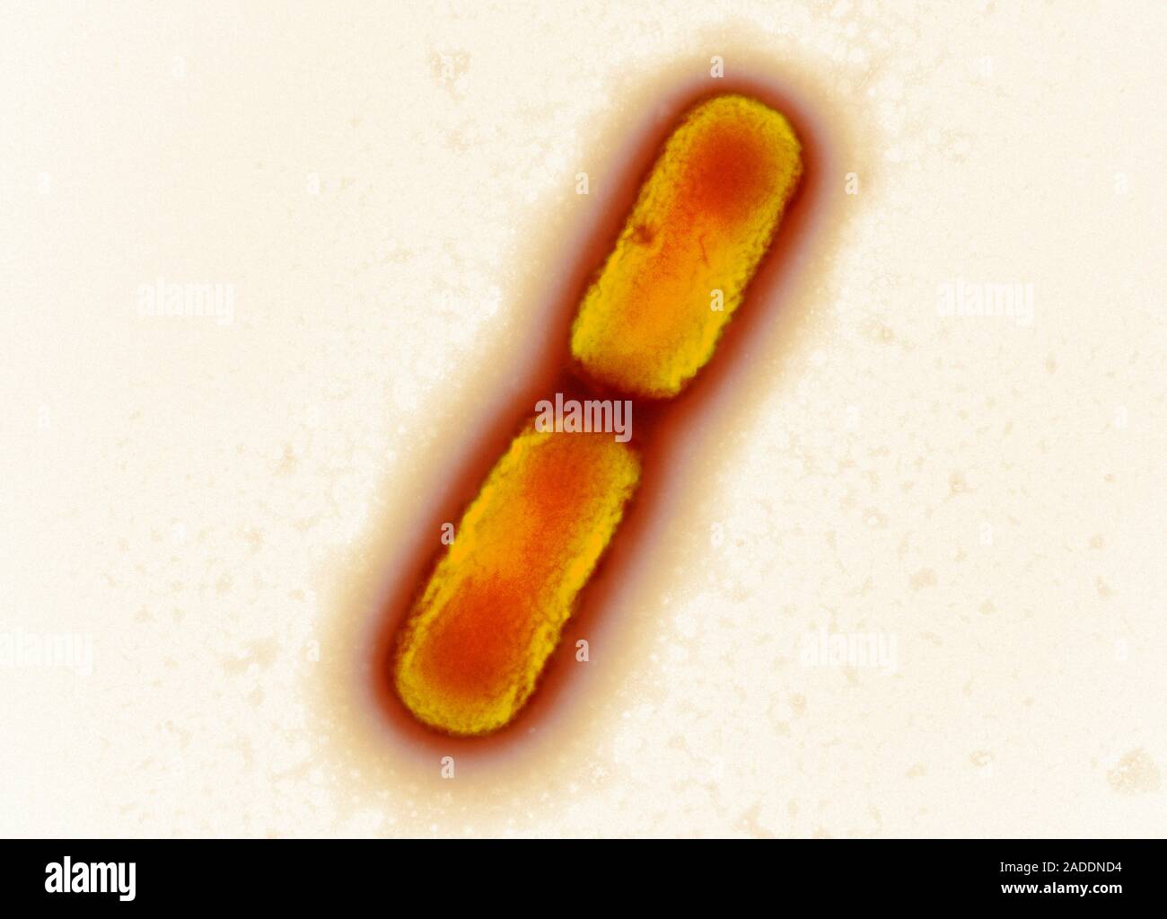Kingella kingae bacteria, coloured transmission electron micrograph ...