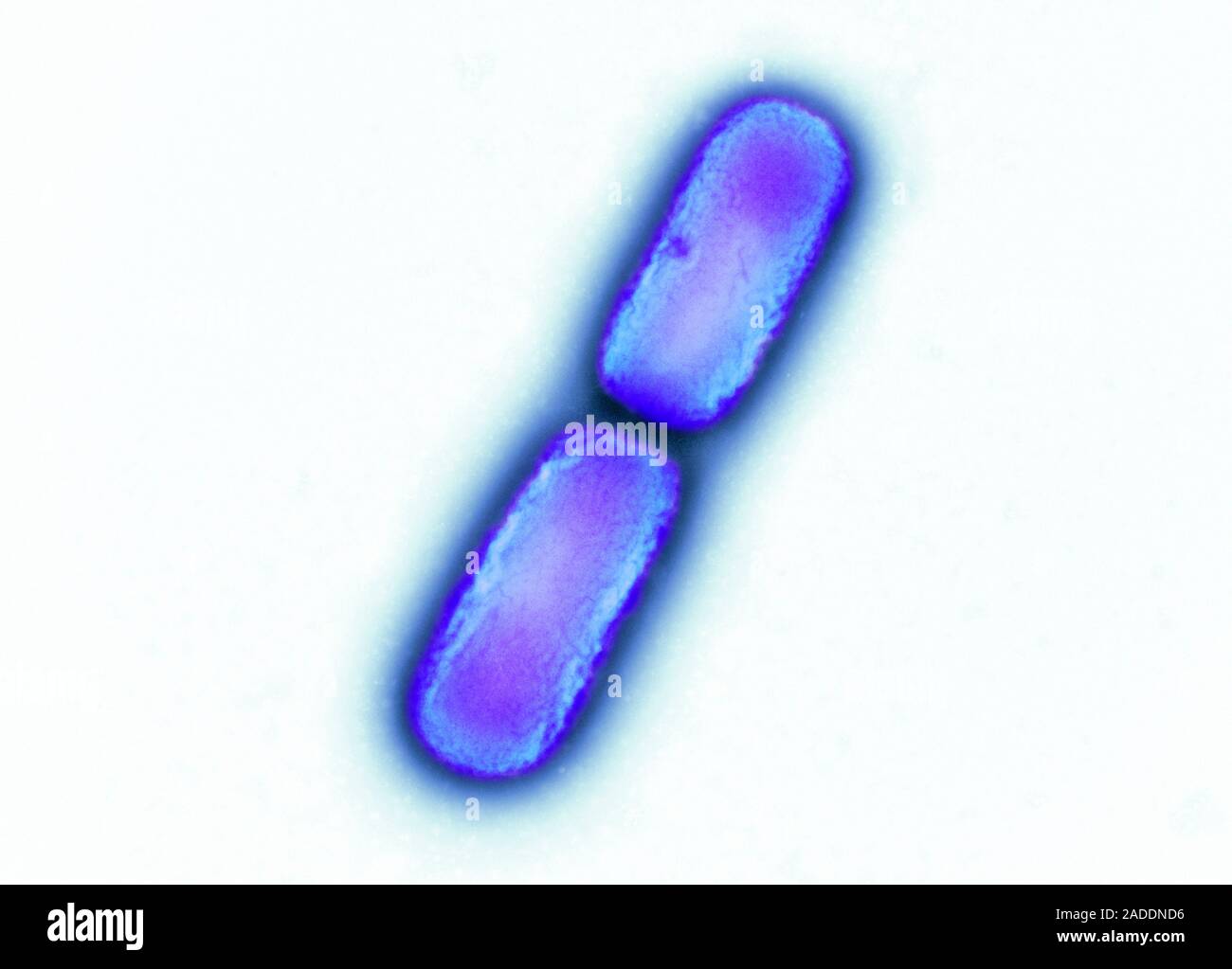 Kingella kingae bacteria, coloured transmission electron micrograph ...