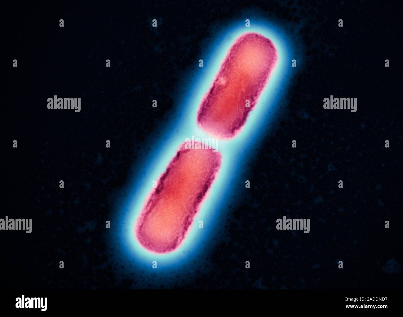 Kingella kingae bacteria, coloured transmission electron micrograph ...