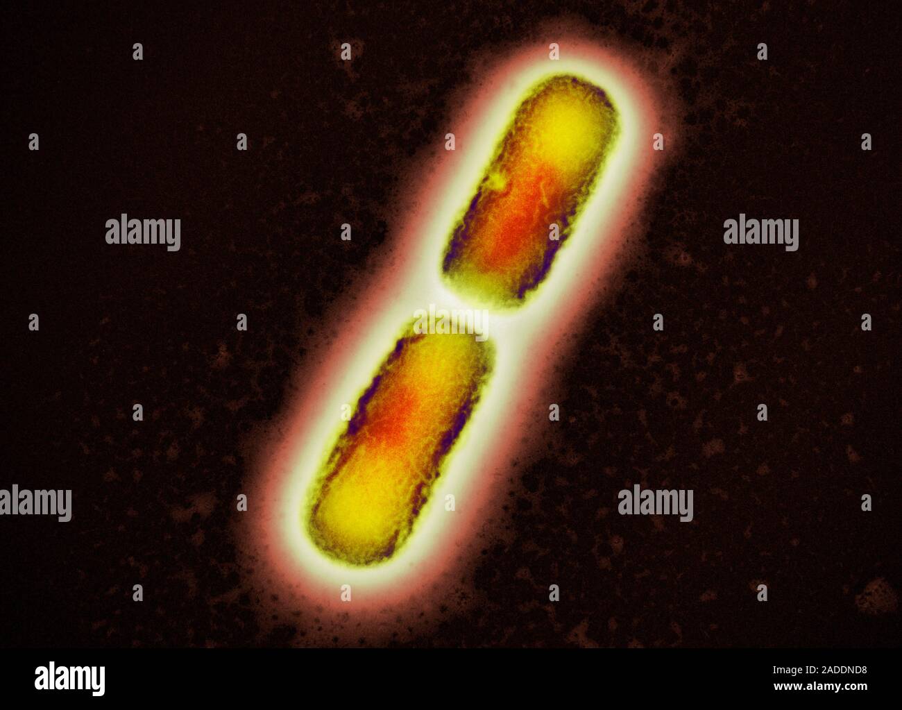 Kingella kingae bacteria, coloured transmission electron micrograph ...