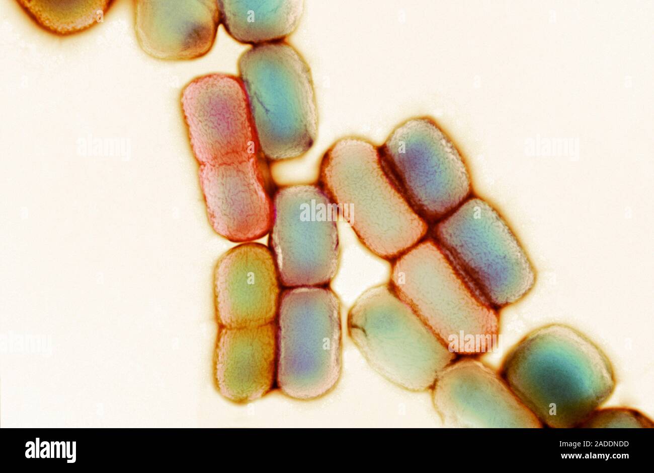 Kingella kingae bacteria, coloured transmission electron micrograph ...