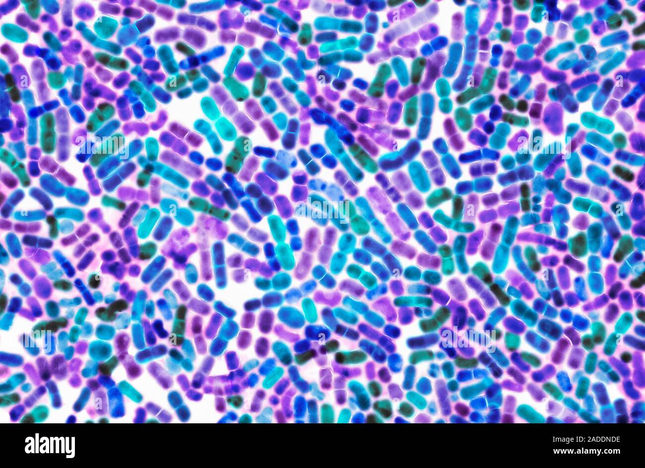 Kingella kingae bacteria, coloured transmission electron micrograph ...