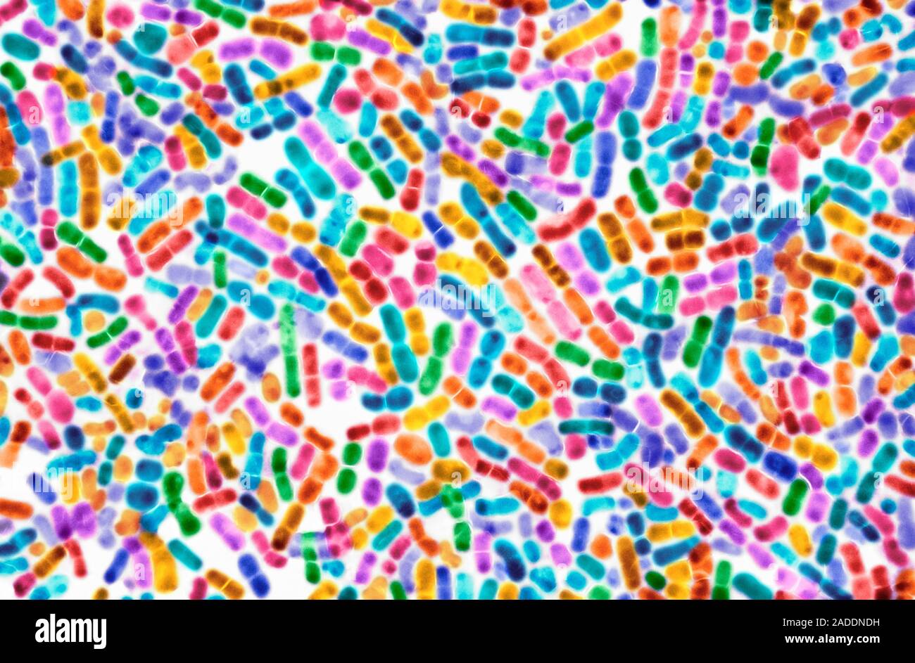 Kingella kingae bacteria, coloured transmission electron micrograph ...