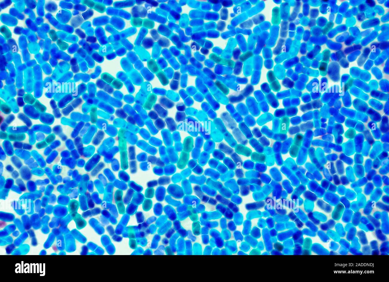 Kingella kingae bacteria, coloured transmission electron micrograph ...