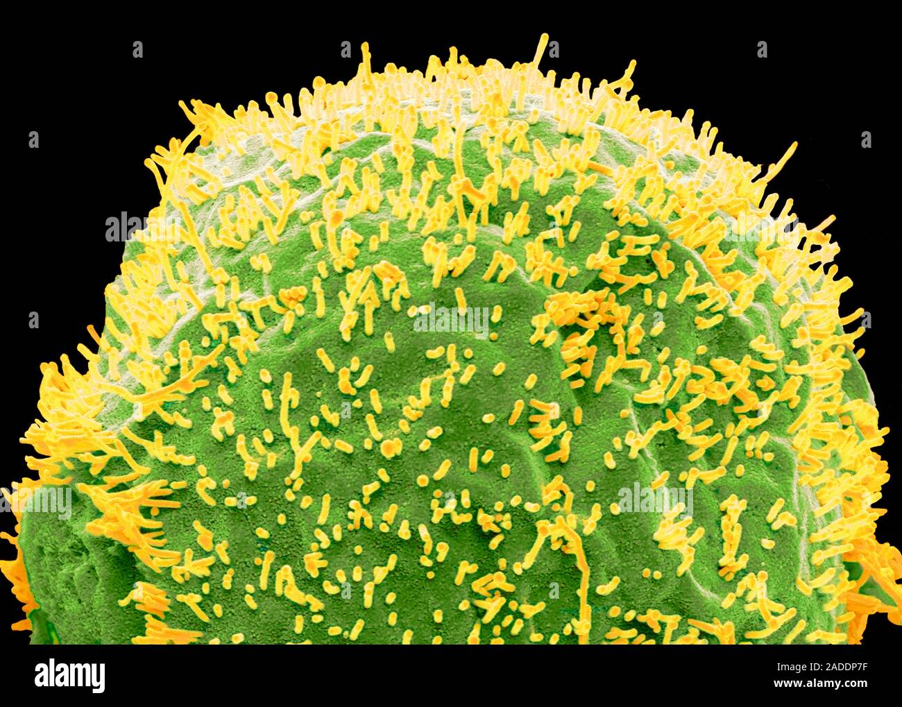 Human cells infected with bird flu virus, coloured scanning electron ...