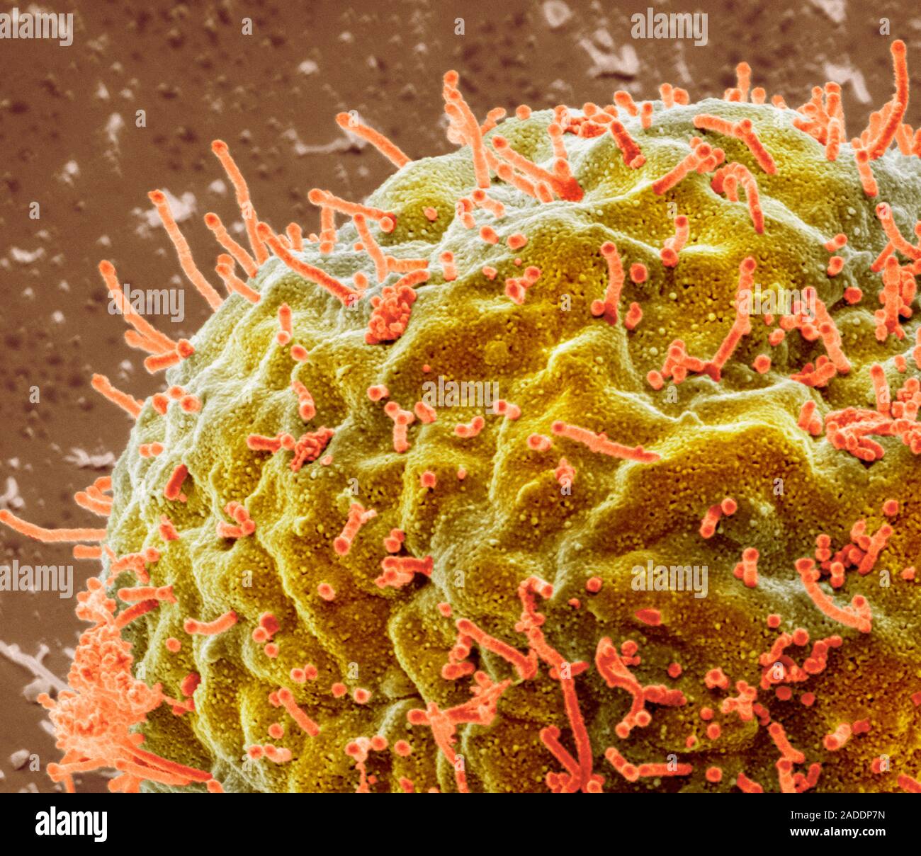Coloured scanning electron micrograph (SEM) of a human cell infected ...