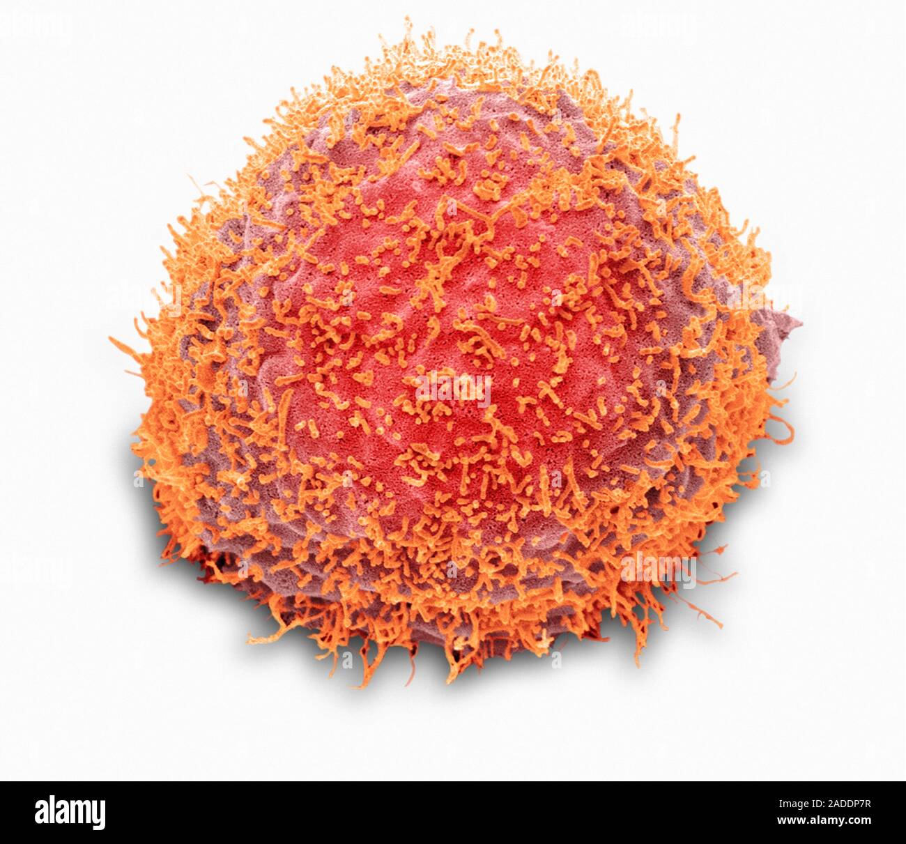 Human cells infected with influenza B virus, coloured scanning electron ...