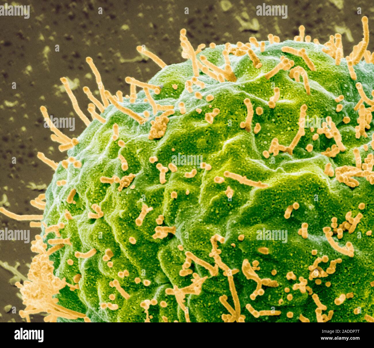 Coloured scanning electron micrograph (SEM) of a human cell infected ...