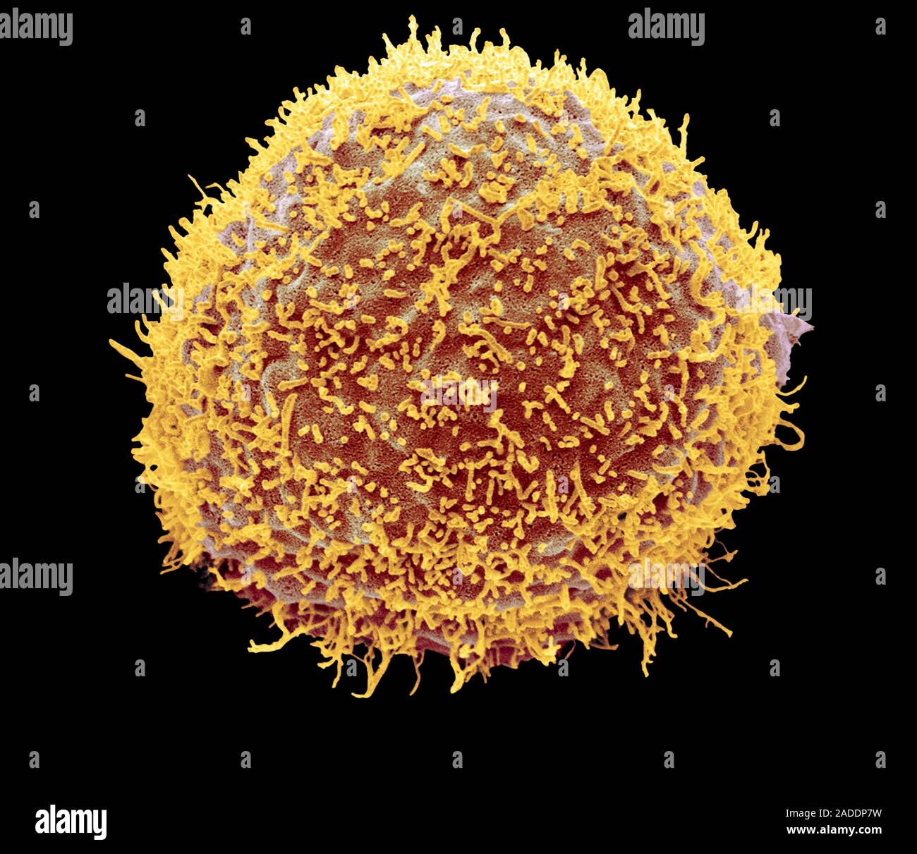 Human cells infected with influenza B virus, coloured scanning electron ...