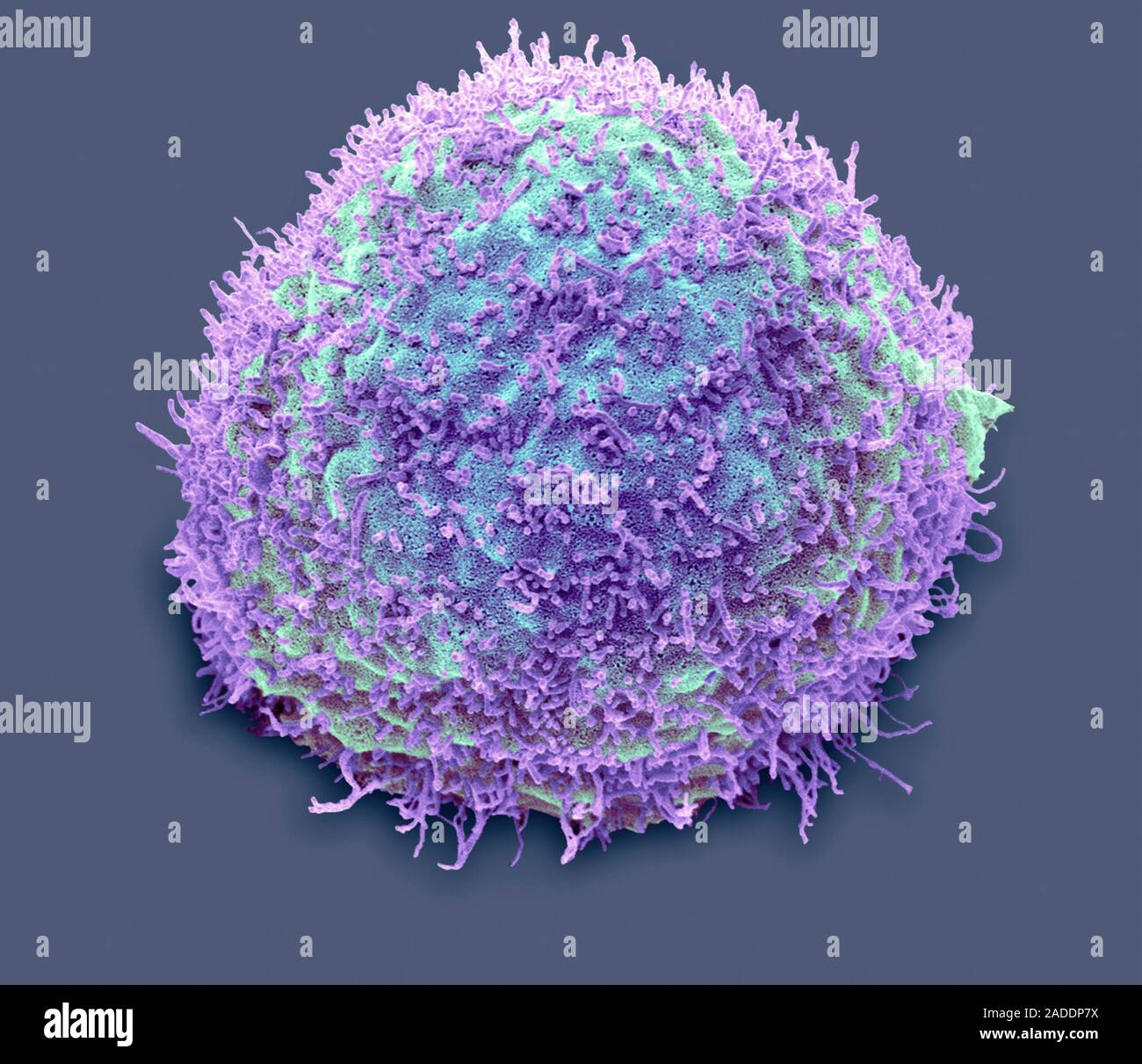Human cells infected with influenza B virus, coloured scanning electron ...