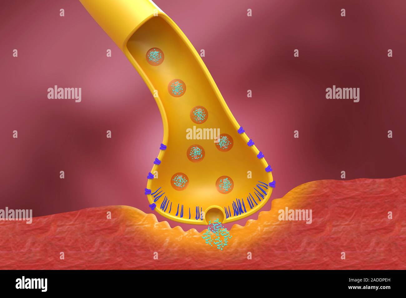 Botulinum toxin nerve block mechanism. Cutaway illustration of a nerve ...