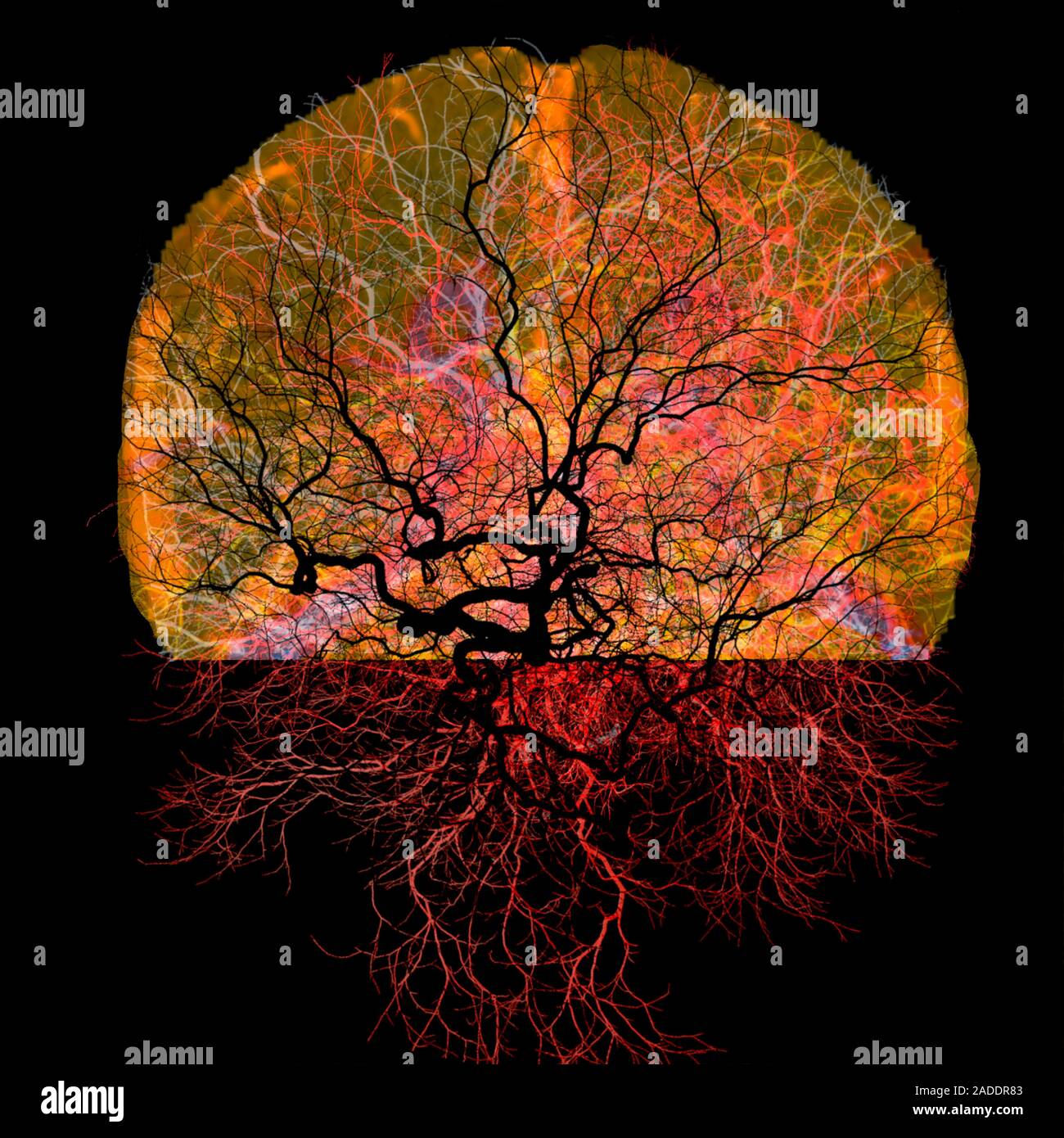 BrainTree artwork. Digital composite of scans of the brain of a stroke ...