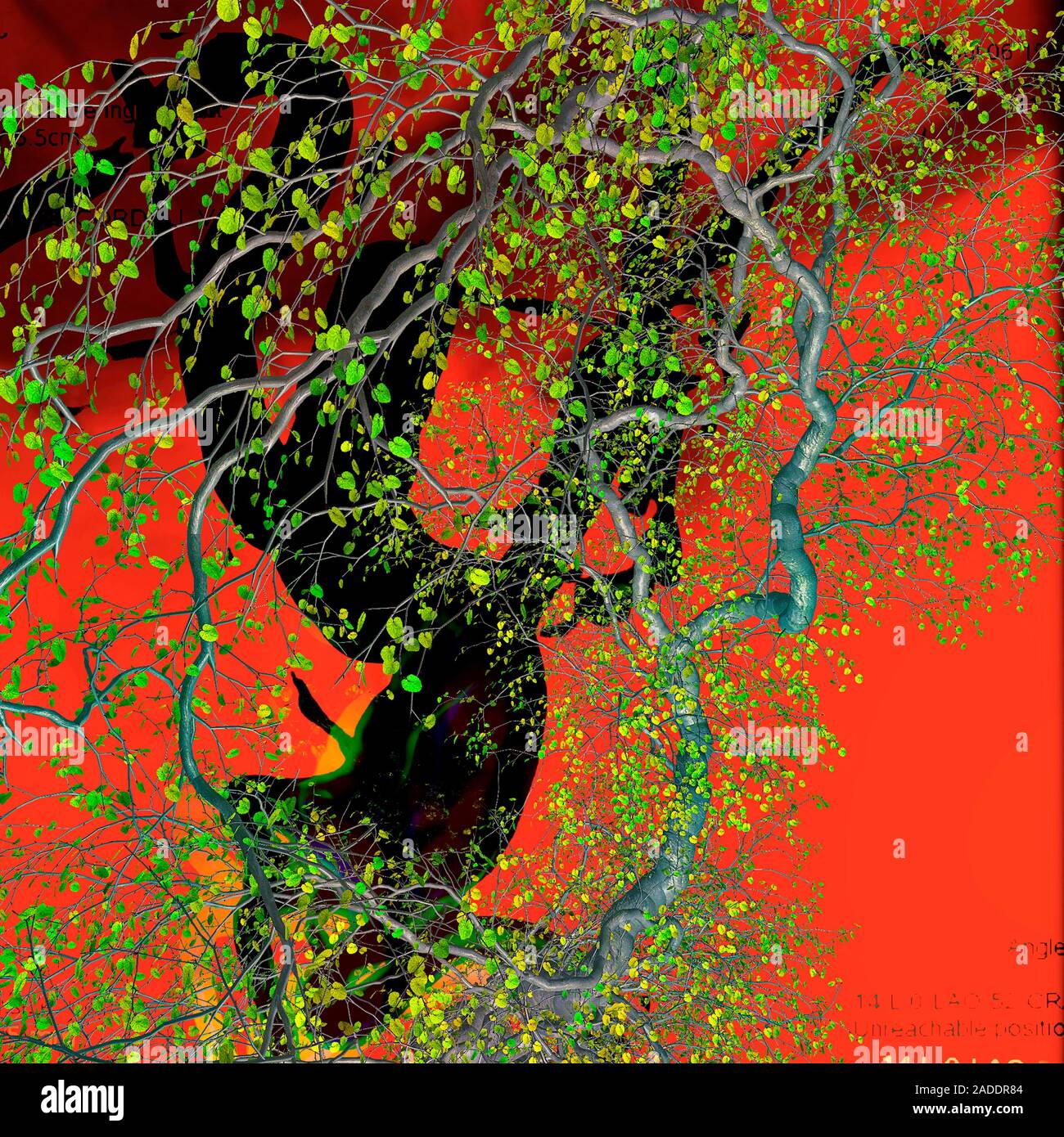 BrainTree artwork. Digital composite of scans of the brain of a stroke ...