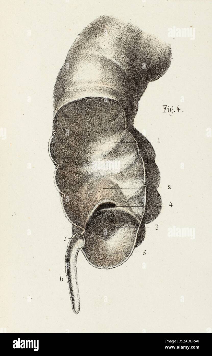 Caecum, 1866 illustration. This part of plate 13 from the third volume ...