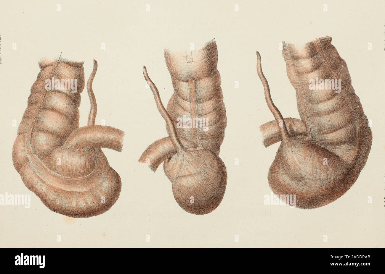 Caecum anatomy, 1866 illustration. This page is plate 14 ter from the ...