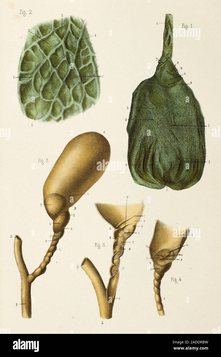 Gall bladder anatomy, 1866 illustration. This page is plate 31 from the ...