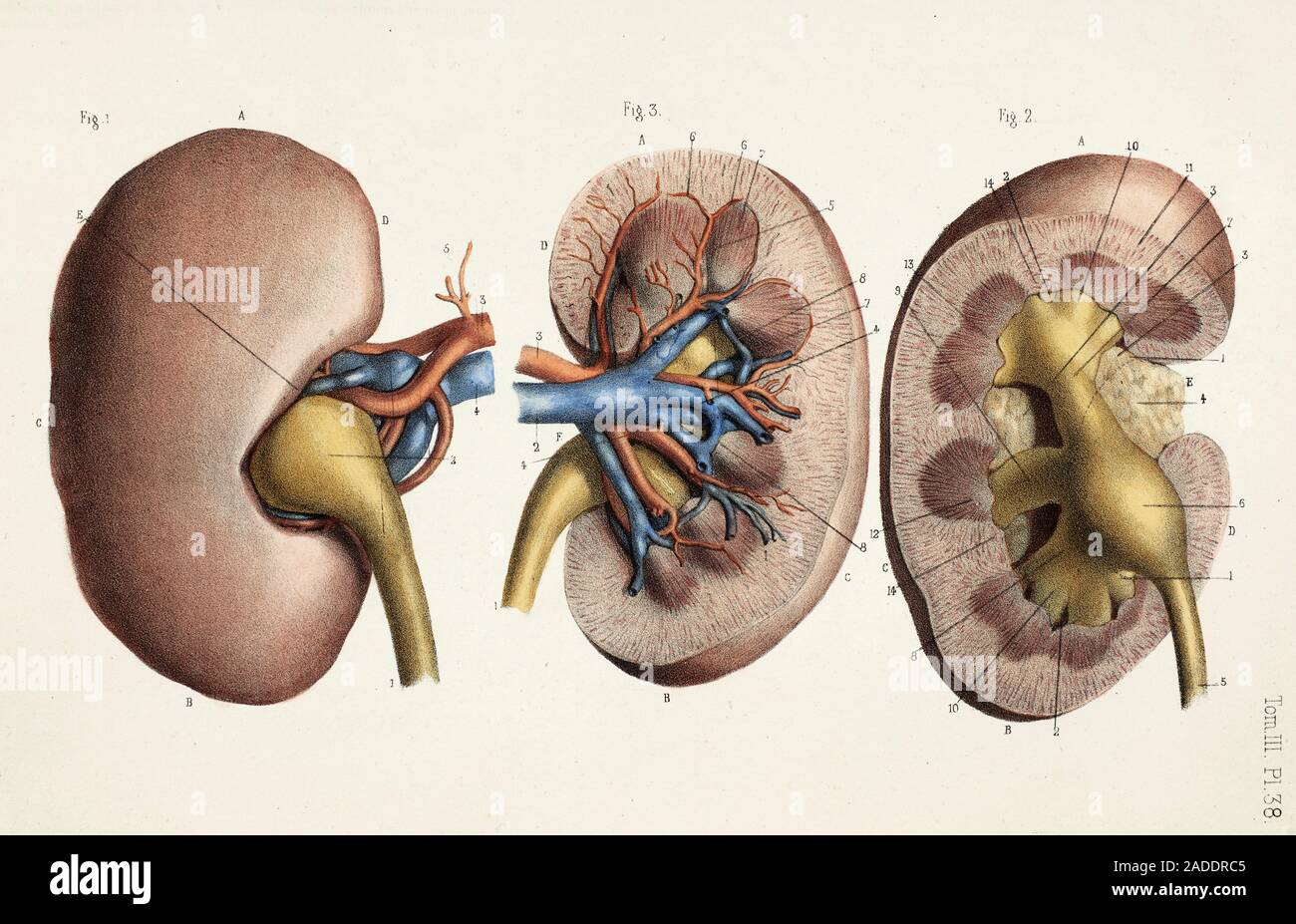 Kidney anatomy, 1866 illustration. The exterior of a kidney is at left ...