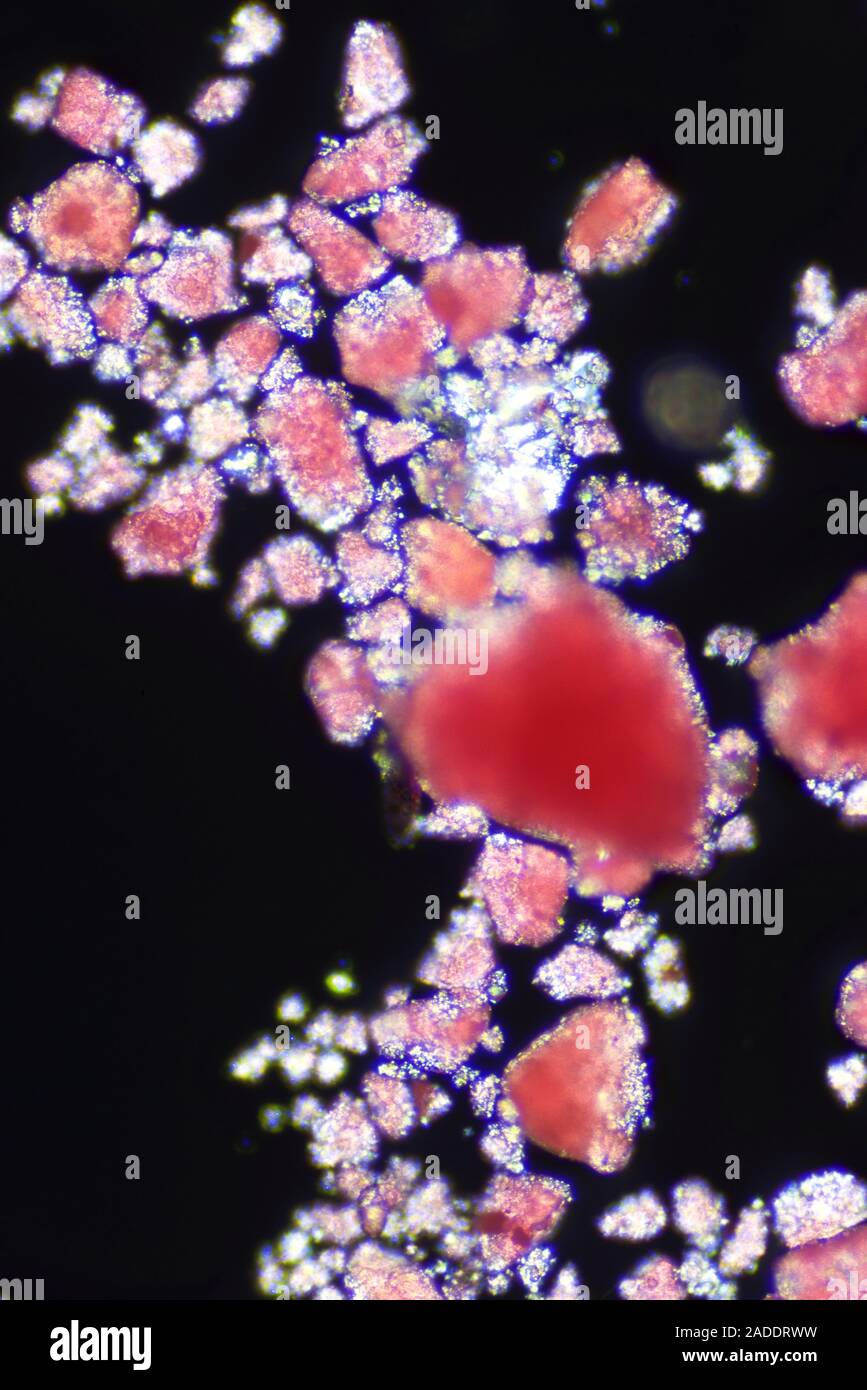 Microplastic particles in a drop of seawater, light micrograph ...