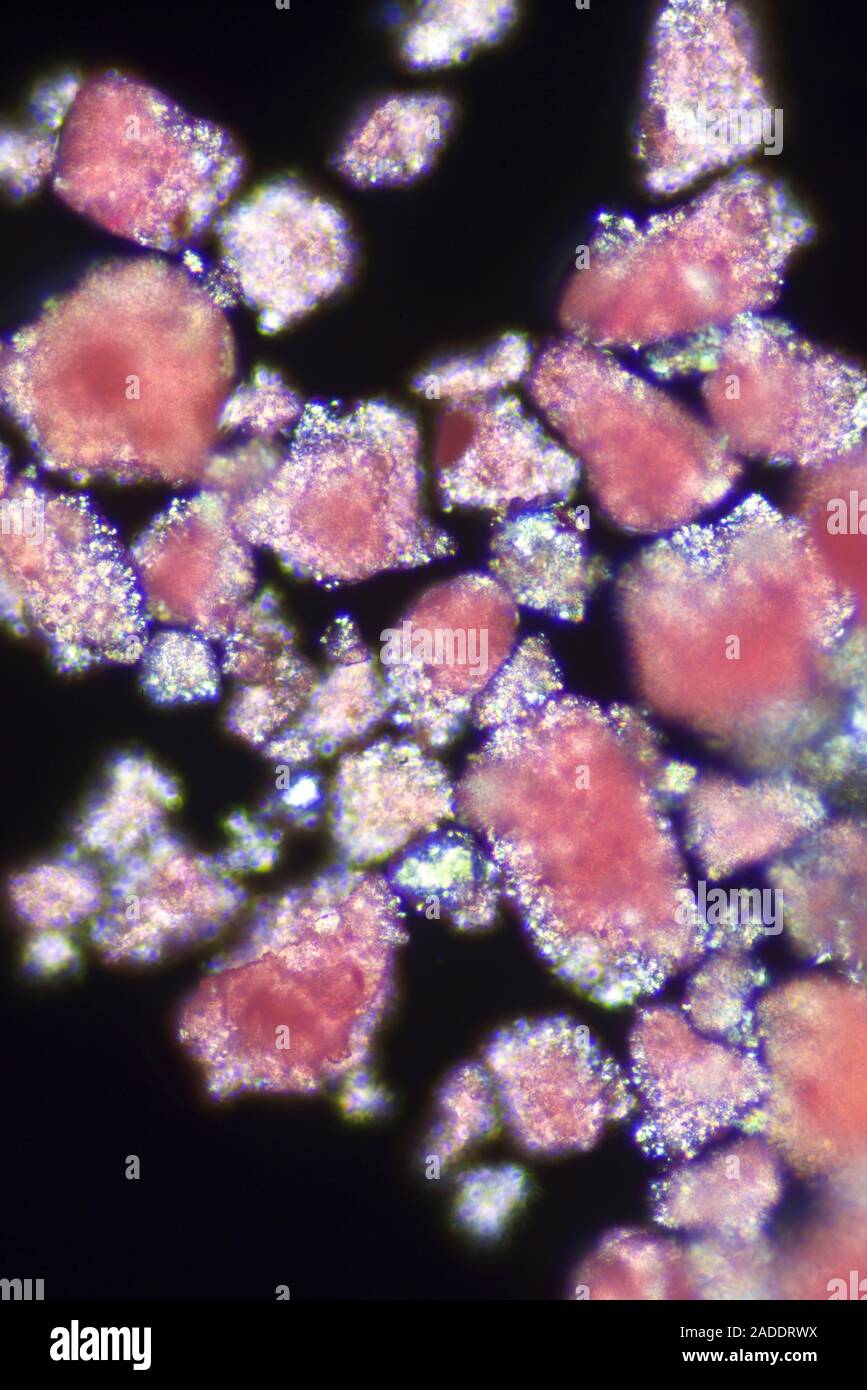 Microplastic particles in a drop of seawater, light micrograph ...