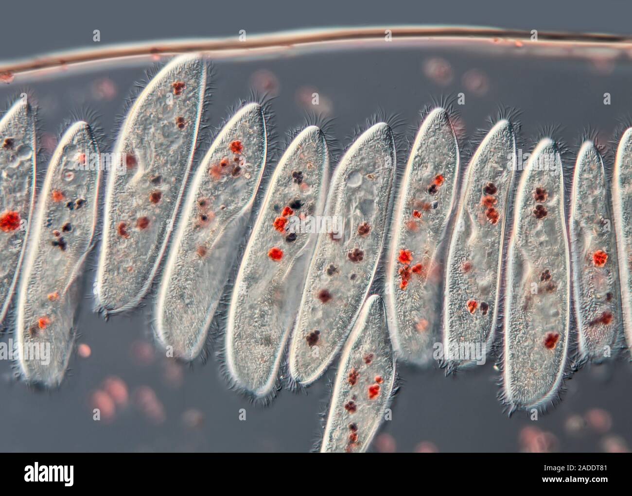 Light micrograph of Paramecium caudatum protozoa, showing food vacuoles containing red-stained ...
