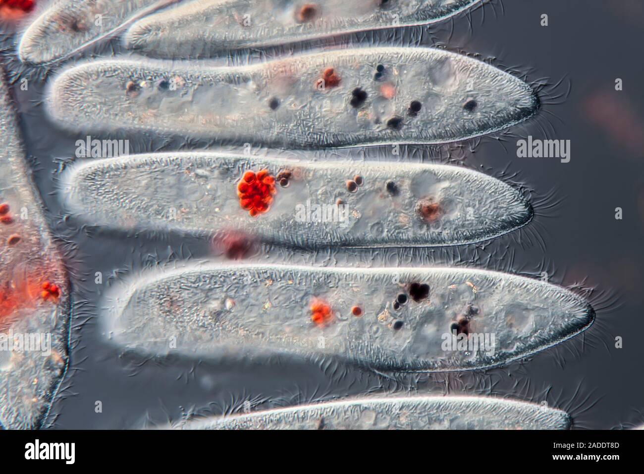Light micrograph of Paramecium caudatum protozoa, showing food vacuoles ...