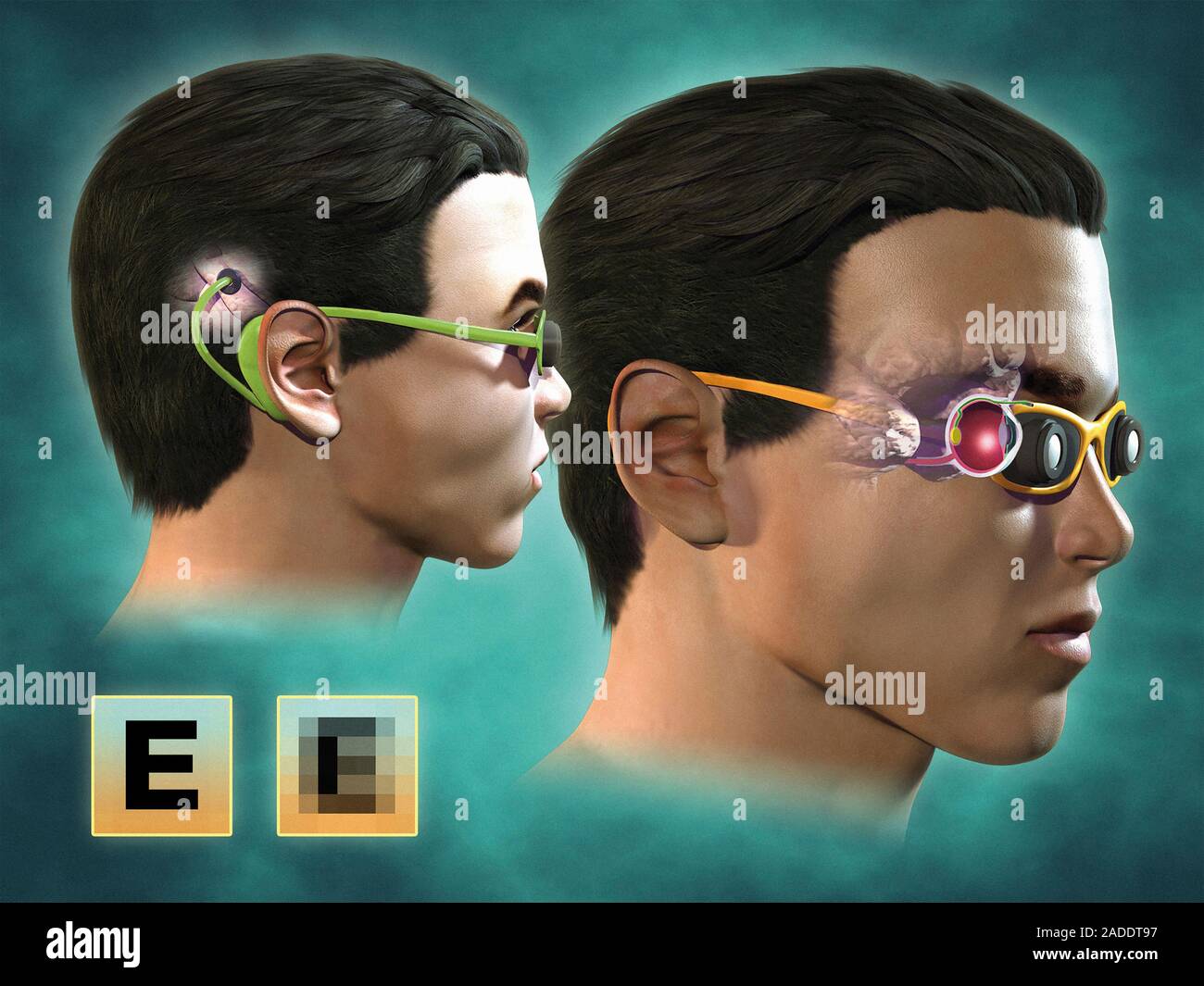 Future bionic eye, illustration. These designs for bionic eyes are ...