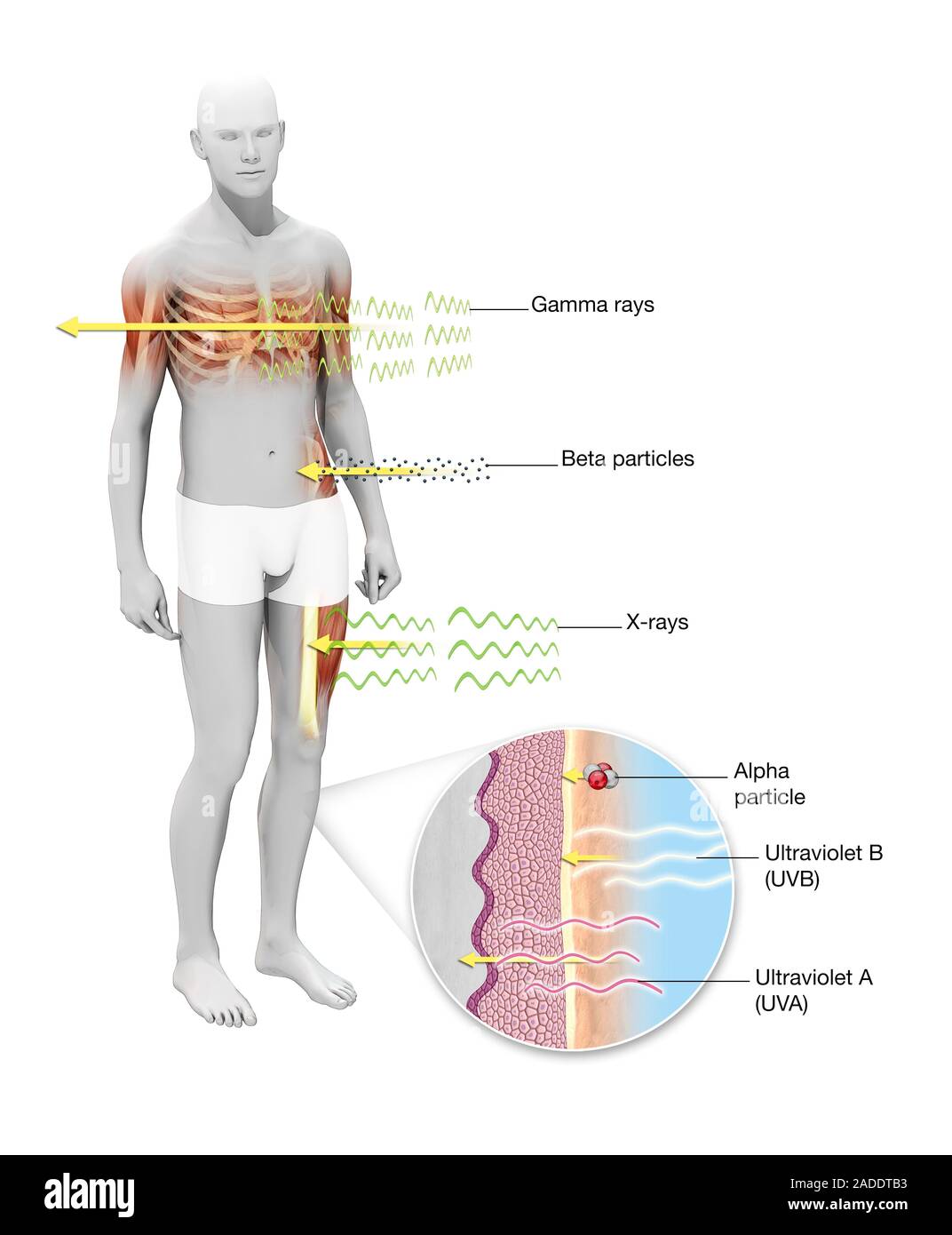 Radiation effects on humans, illustration. Six types of radiation are ...