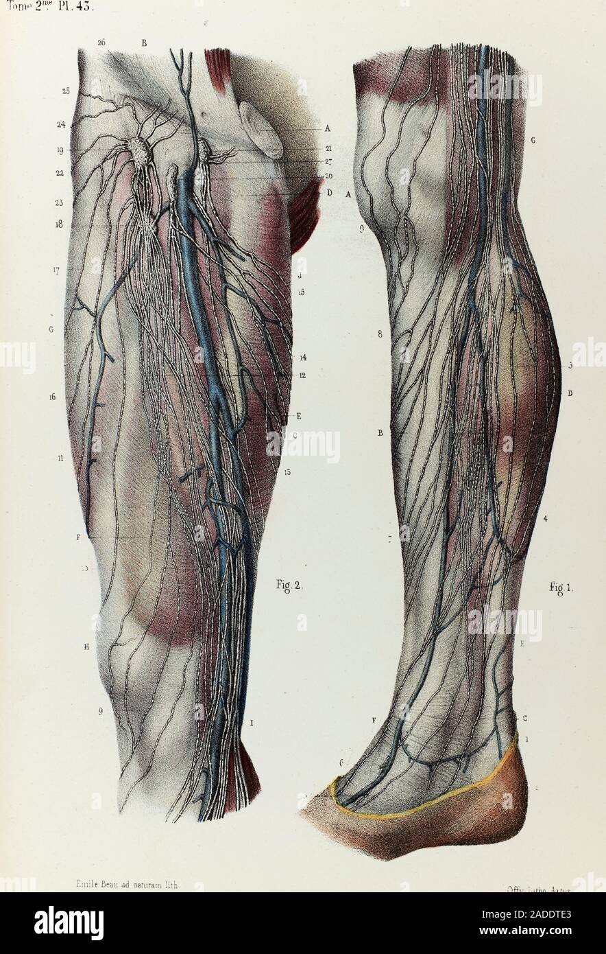 Leg lymphatic vessels, 1866 illustration. The thigh is at left, with ...
