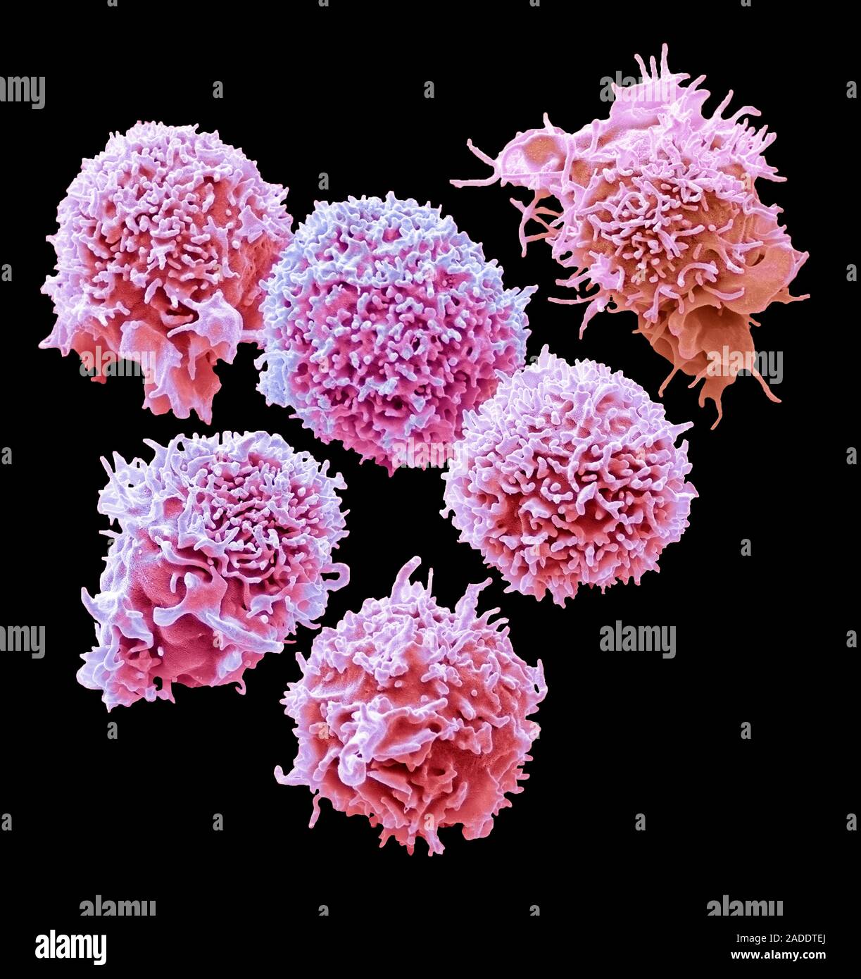 Natural killer (NK) cells, coloured scanning electron micrograph (SEM ...