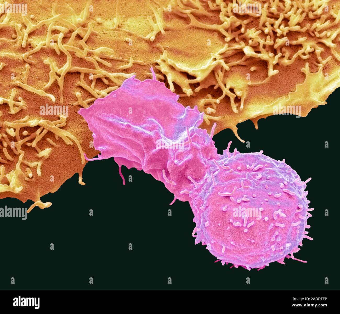 Natural killer (NK) cell interacting with hepatoma cell (HepG2 ...