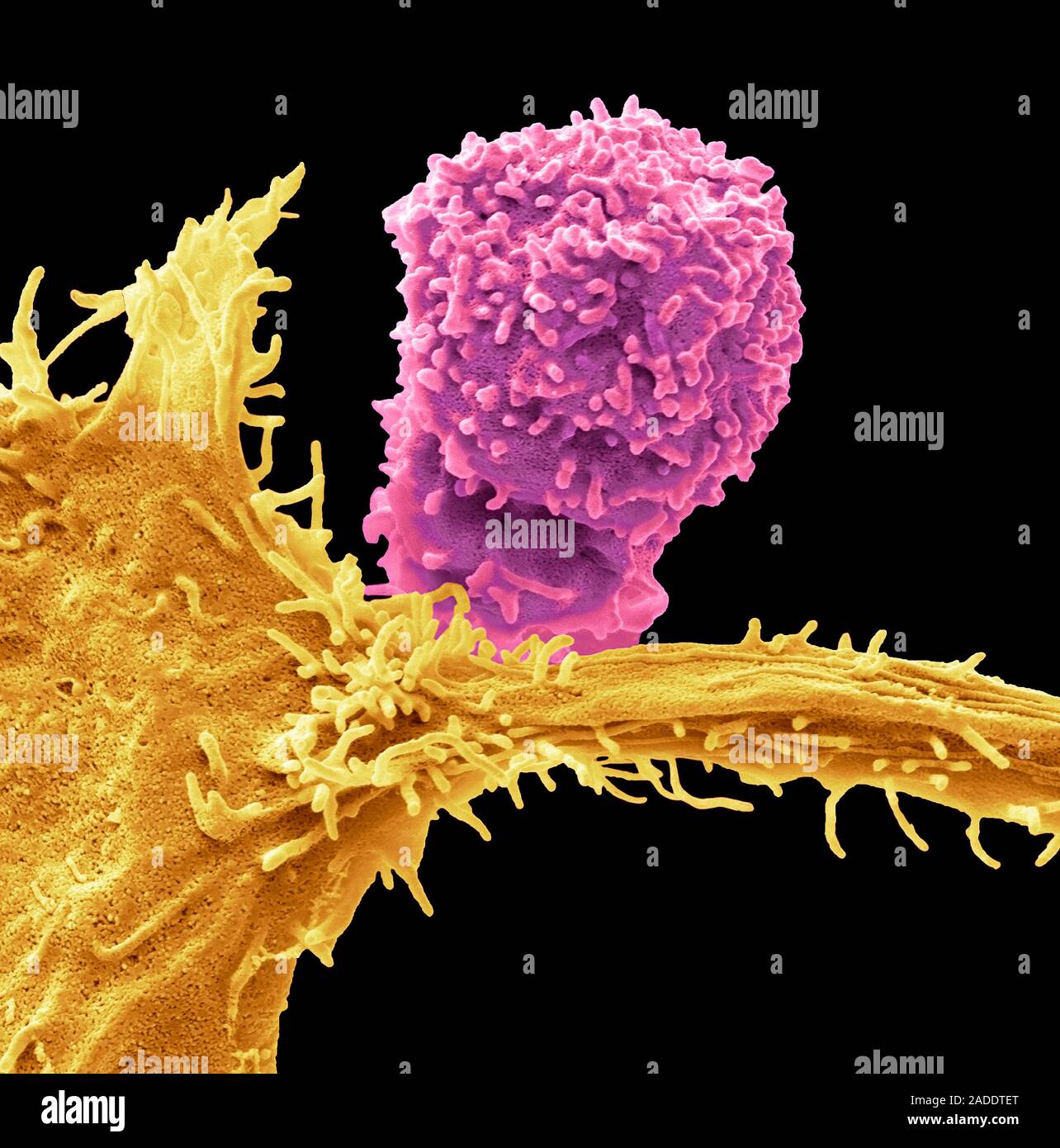 Natural killer (NK) cell interacting with hepatoma cell (HepG2 ...