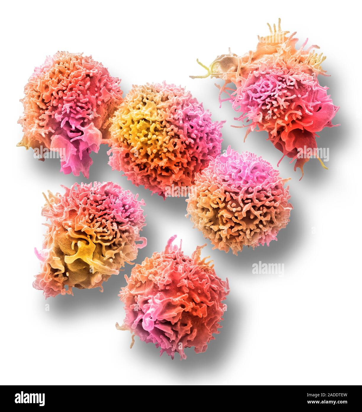Natural killer (NK) cells, coloured scanning electron micrograph (SEM ...